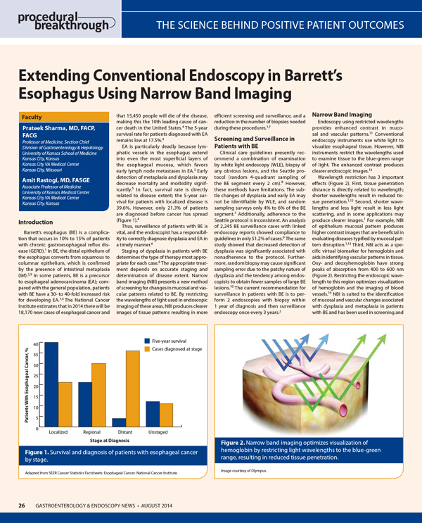 Extending Conventional Endoscopy in Barrett's Esophagus Using Narrow ...