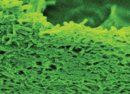 Reducing Cipro Use Stopped C. diff Outbreak