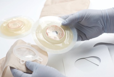 Loop Ileostomy With Lavage Appears Effective for C. diff Disease