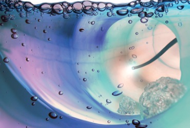 ‘Underwater’ Colonoscopy Beats Air Insufflation for Detecting Polyps ...
