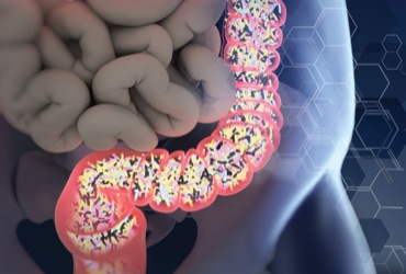 Stubborn C. diff? Look for Other Gut Trouble