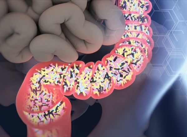 Stubborn C. diff? Look for Other Gut Trouble