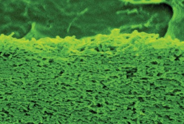 Reducing Cipro Use Stopped C. diff Outbreak