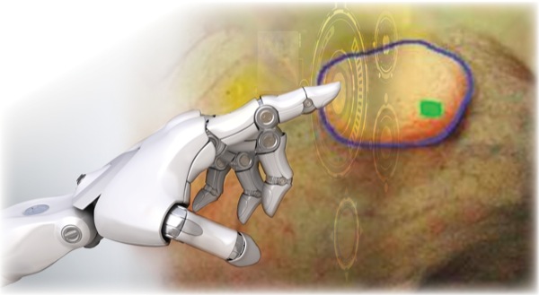 Artificial Intelligence Arrives in GI