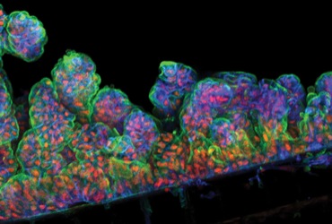 Intestine-on-a-Chip, a Milestone in Personalized Medicine