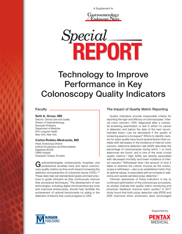 Technology to Improve Performance in Key Colonoscopy Quality Indicators