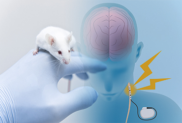 Neuromodulation Shown to Benefit OIC