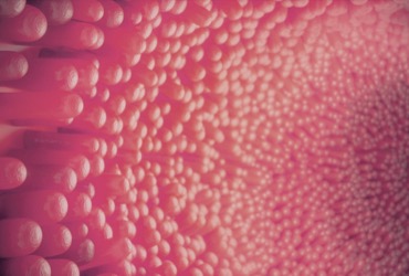 Newfound Mechanisms of Intestinal Fibrosis Could Lead to Prevention ...