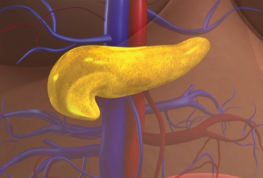 Pancreatic Cystic Lesions: Diagnosis, Evaluation, and Management