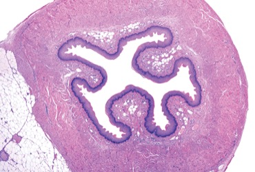 Dr. Sharma’s Endoscopy Insights: EoE a Family Affair, and More