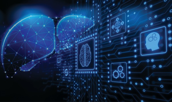 AI and Machine Learning in the Management of Liver Disease ...