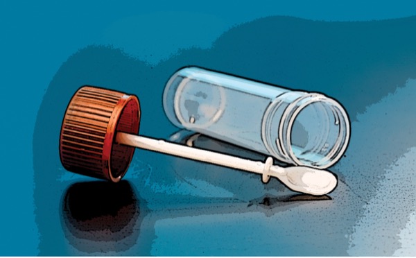 Stool-Based Testing Could Reduce Unnecessary Surveillance Colonoscopies ...