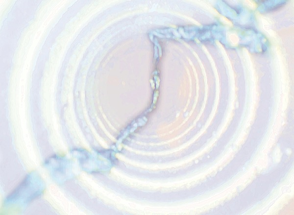 Fluid Retention Channel Shredding GI GI Scope Scopes Borescope