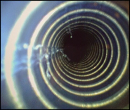 Fluid Retention, Channel Shredding Common in GI Scopes