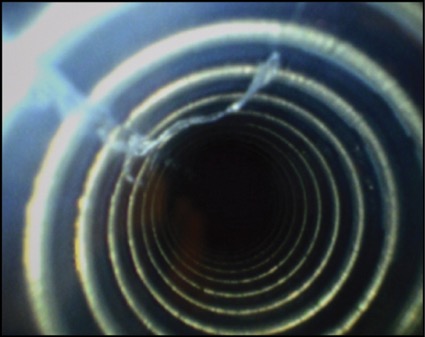 Fluid Retention, Channel Shredding Common in GI Scopes