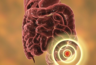 Meta-Analysis: Snare Tip Soft Coagulation Reduces Recurrence in ...