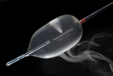 Cryoballoon Ablation Comparable to RFA For Eradicating Dysplastic Barrett’s