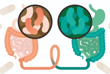 fecal microbiota transplant immune-mediated colitis