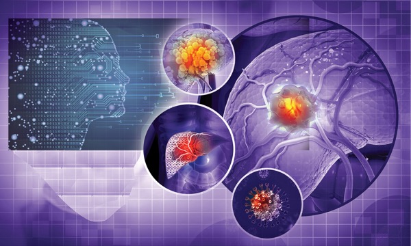 hepatocellular carcinoma liver cancer AI detection
