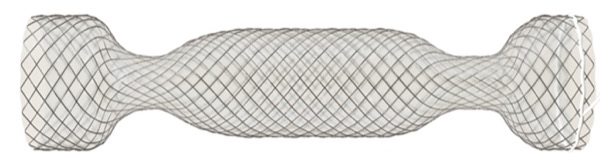 Gastrointestinal Enteral Stents: Esophageal