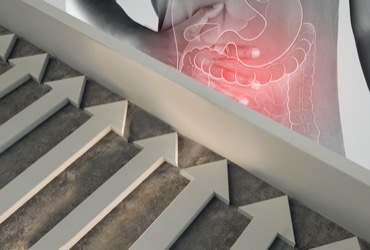 Possible Therapeutic Ceiling for CD, and Clinical Judgment Critical ...