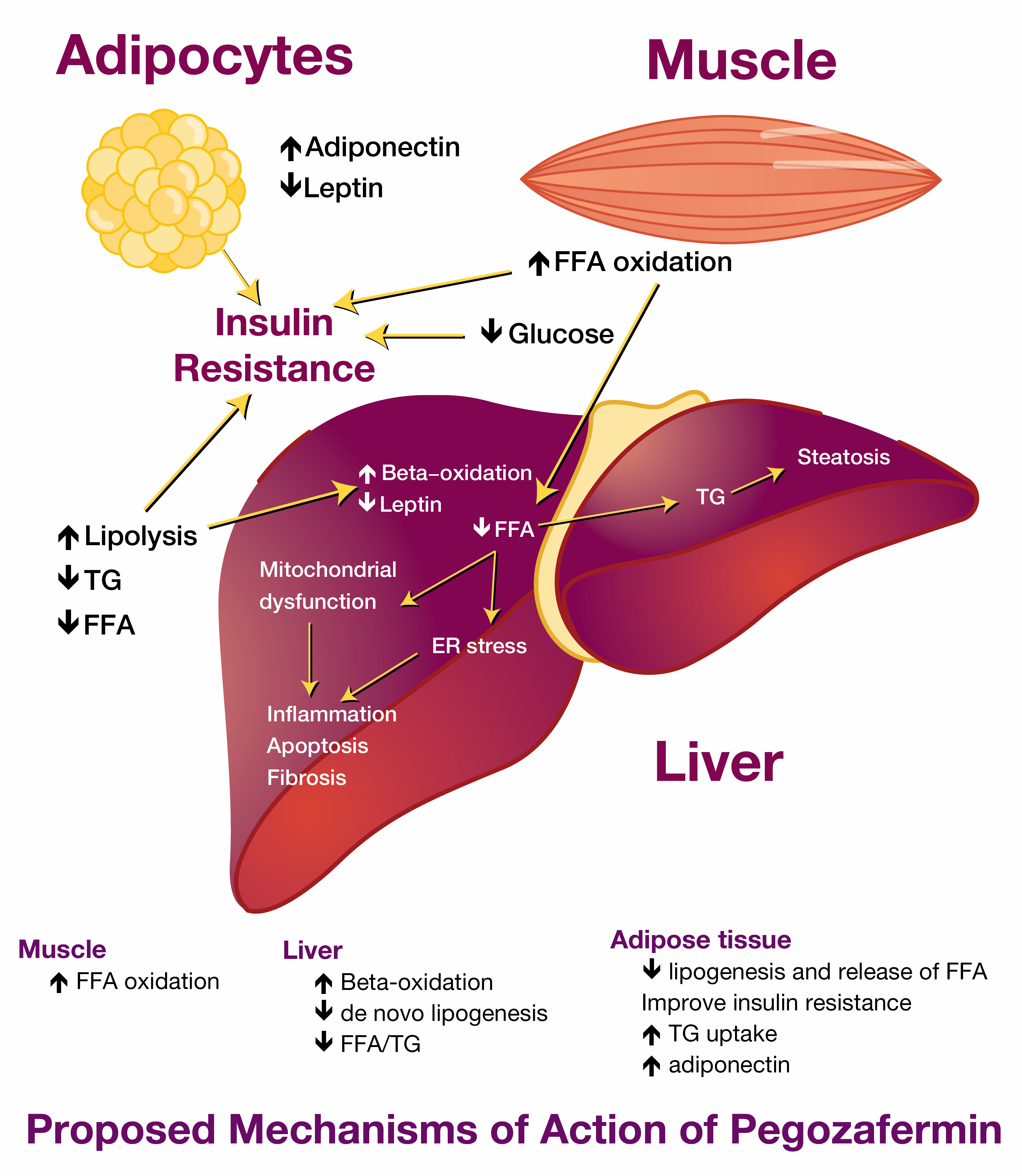 Pegozafermin Shows Promise for Treating MASH