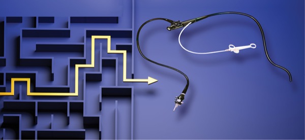 WGO Releases New Guidelines for Safe Endoscope Reprocessing