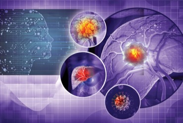hepatocellular carcinoma liver cancer AI detection