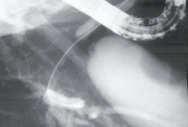 endoscopic retrograde cholangiopancreatography ERCP 10 tips