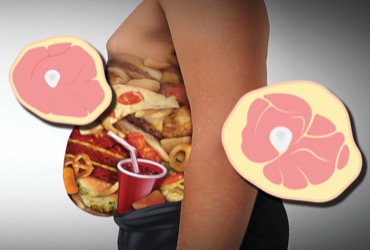 obesity malnutrition diagnosis management