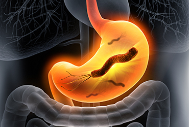 FDA Approves sDNA to Extend H. pylori Drug Dosing to New Regimen
