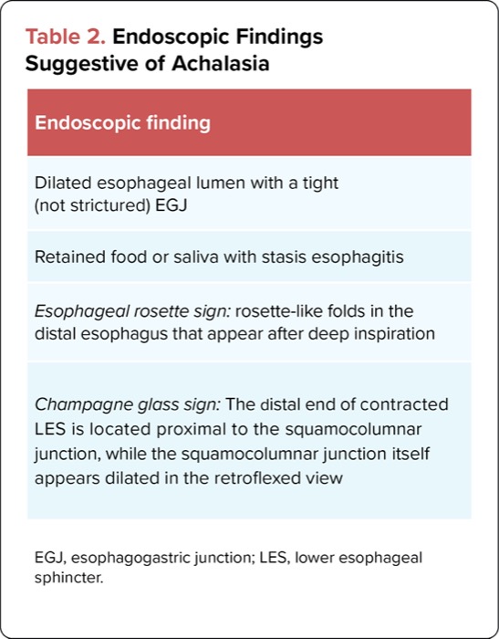 Management of Achalasia