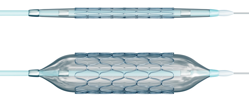 Gastrointestinal Enteral Stents: Colorectal