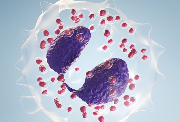 A Simple Test Avoids EoE Misdiagnosis, Treatment