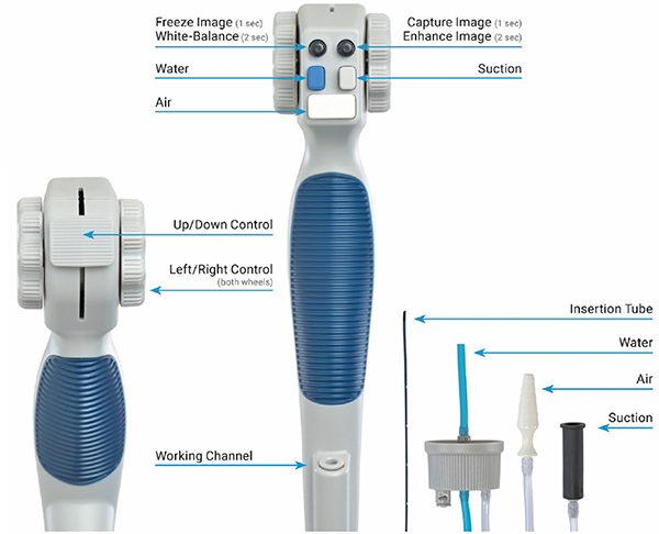 Transnasal Endoscopy: EvoEndo Ultra-Slim, Single-Use Gastroscope, Part ...