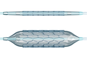 colorectal enteral stents
