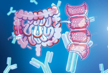 Top-Down Therapy Proves Its Worth in Crohn’s Disease