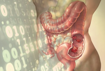 Evaluation of Computer-Aided Colonoscopy Polyp Diagnosis Shows Mixed ...