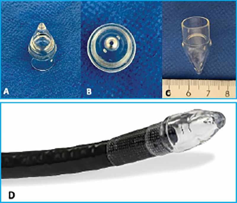 Esophageal Stricture Dilation Using the Novel BougieCap