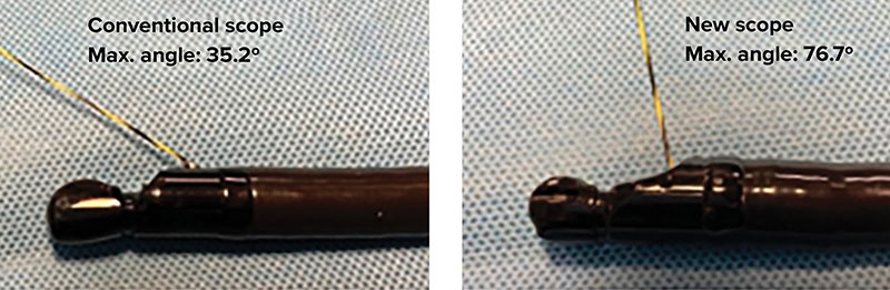 Therapeutic Endoscopic Ultrasound Innovations