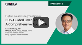 Tulisokibart May Be a Promising Treatment For Ulcerative Colitis