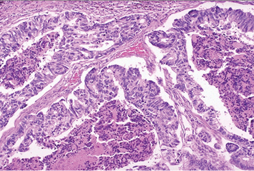 Expert Picks From ACG 2024: Part 2