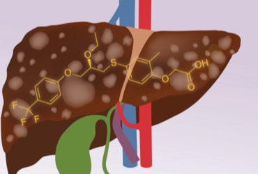 Seladelpar Safe Effective Primary Biliary Cholangitis Cirrhosis PBC