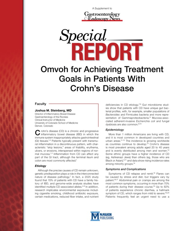 Omvoh Crohn's Disease