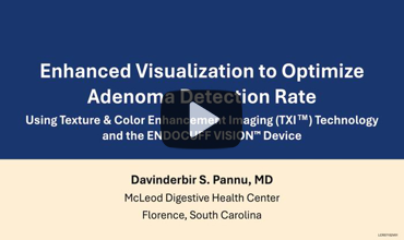 Enhanced Visualization to Optimize Adenoma Detection Rate Using Texture ...